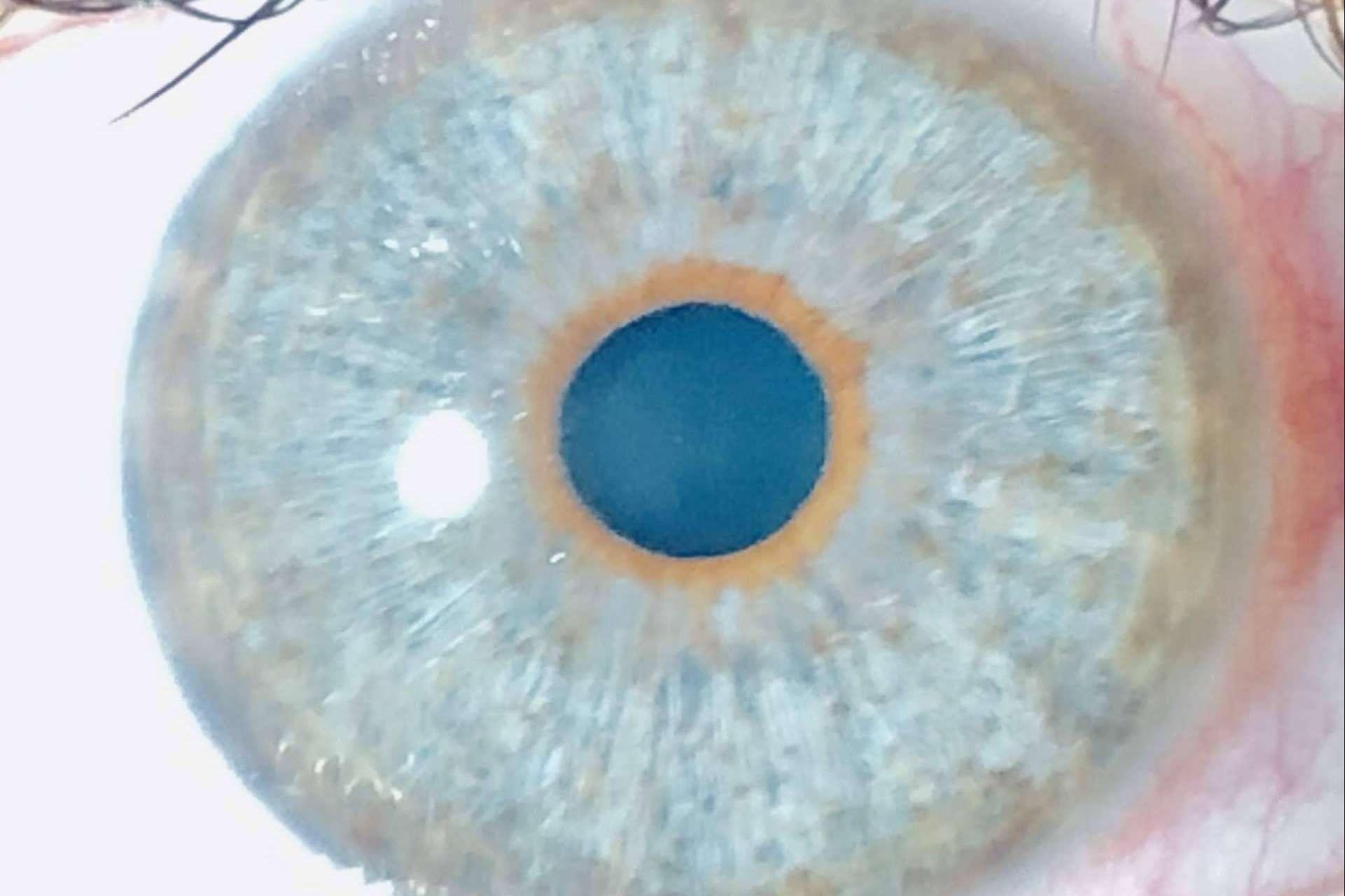 Eyecos estudia la distribución del color de ojos - La Cronica Siete