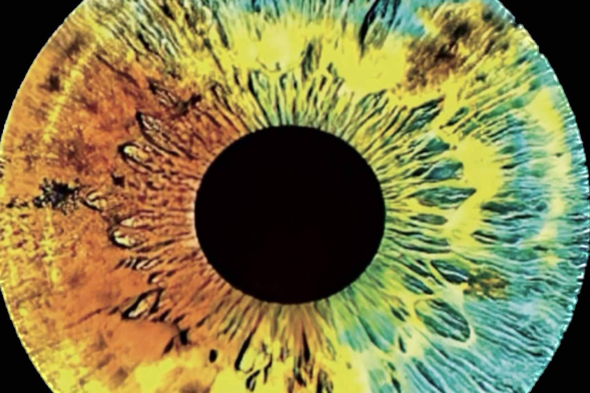 Investigación sobre los genes del color de ojos, por Clínica Eyecos ...